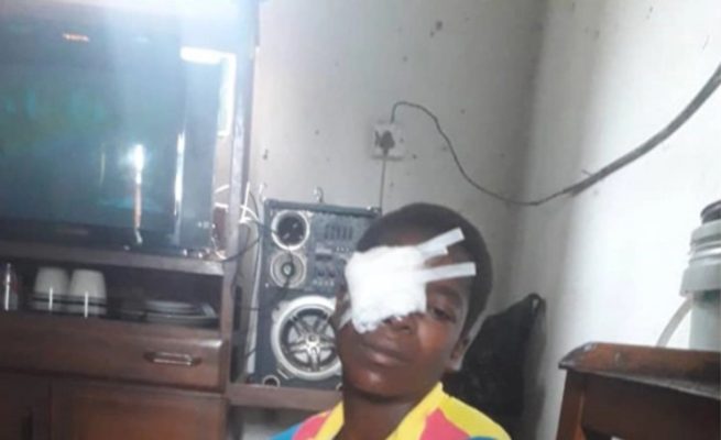 tsitsi eye plucked out | My Zimbabwe News