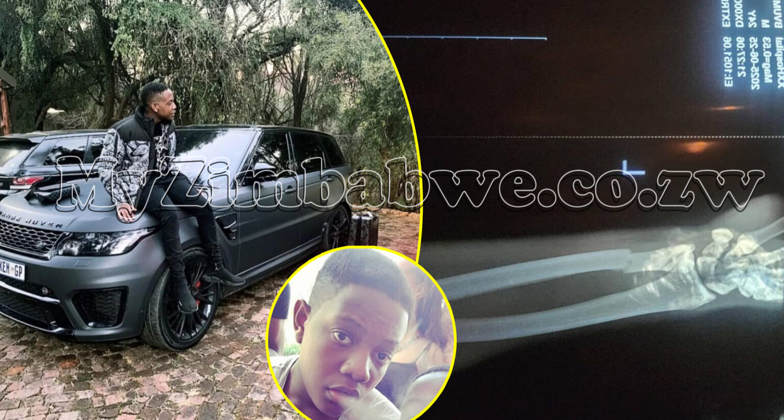 Guard suffers broken bone, fights for life after brutal assault by ...